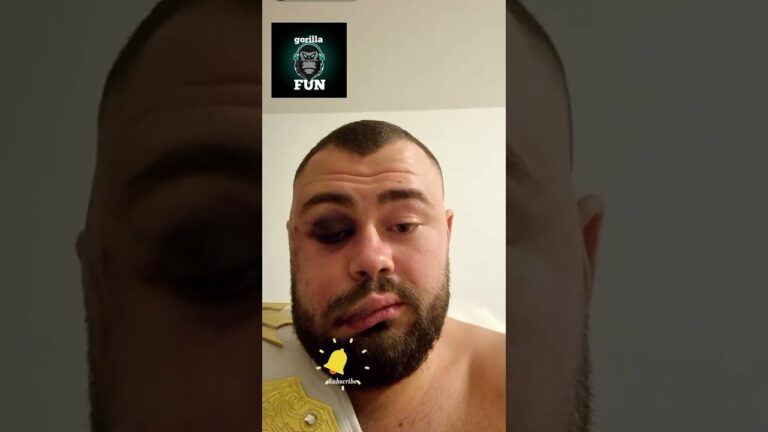 Romanian Slapper's face actually looks even worse after his viral incident