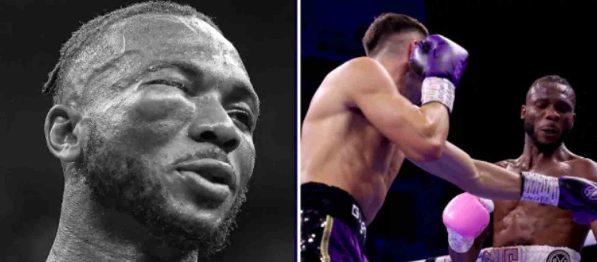 Boxer Linus Udofia had an eye swell shut in defeat to Conway