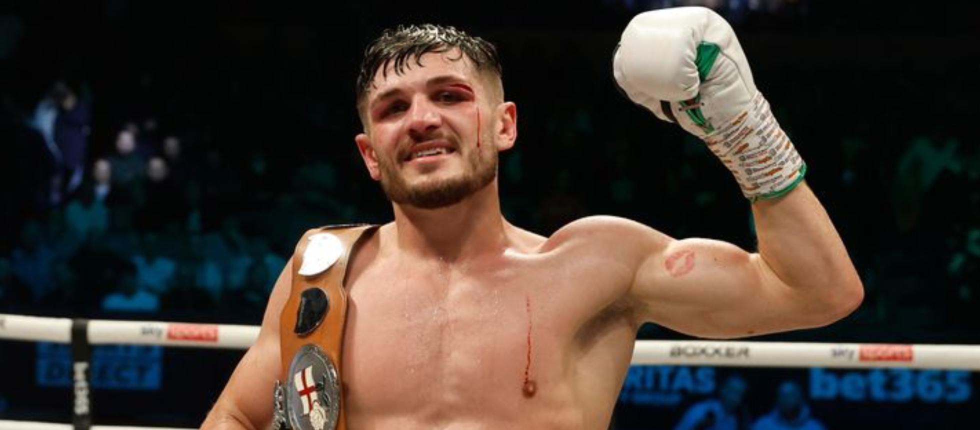 Boxer abandons presser after horror gash above his eye