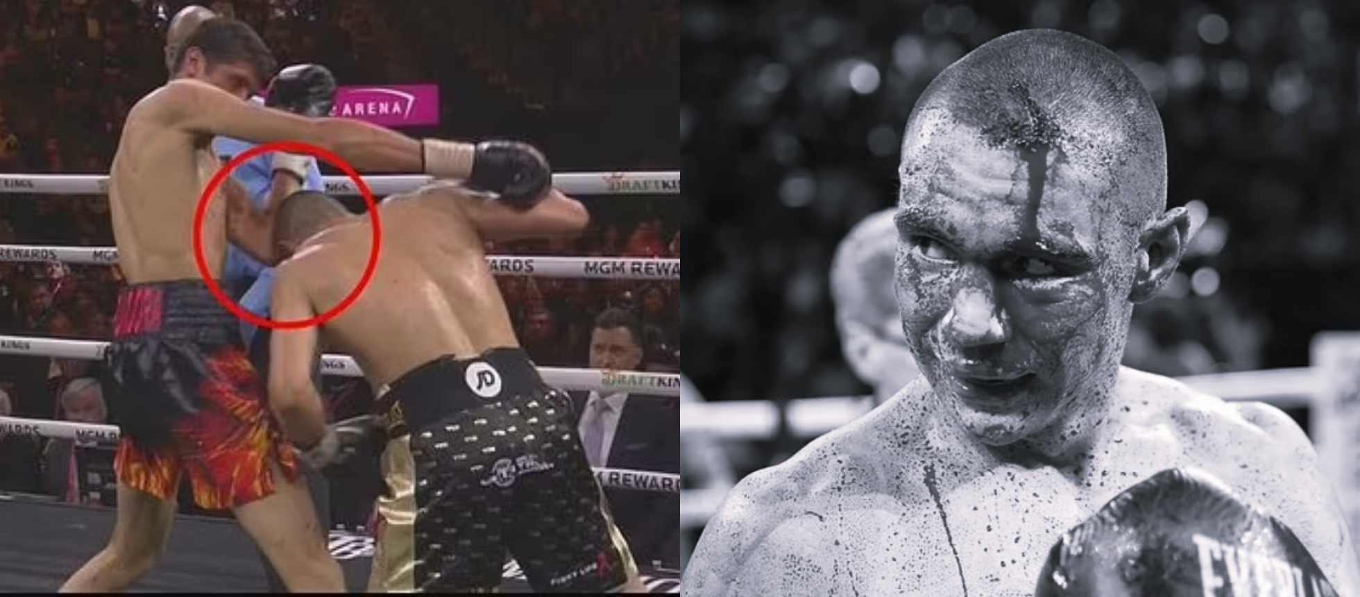 (Video) Accidental Elbow Leads to Tim Tszyu's Loss in Bloody Boxing Bout