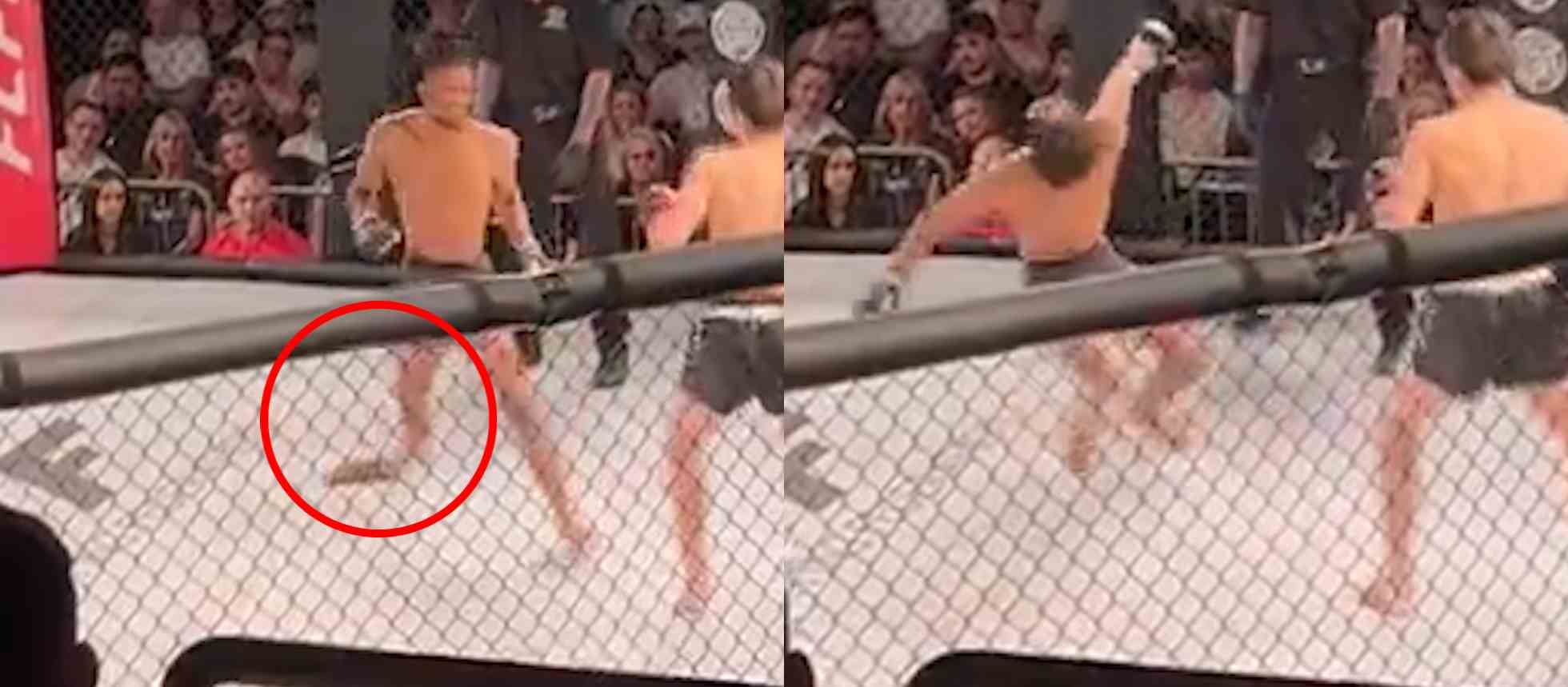 (Video) Yikes: MMA star's leg audibly snaps in front of a crowd of ...