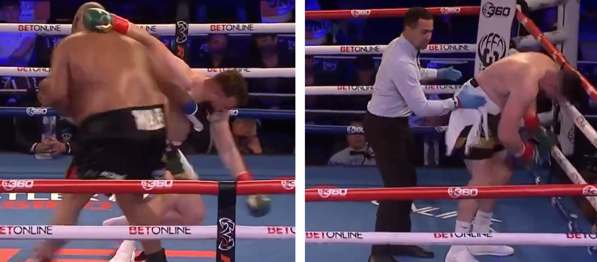 (Video) Boxing favorite loses bout after blowing out his knee
