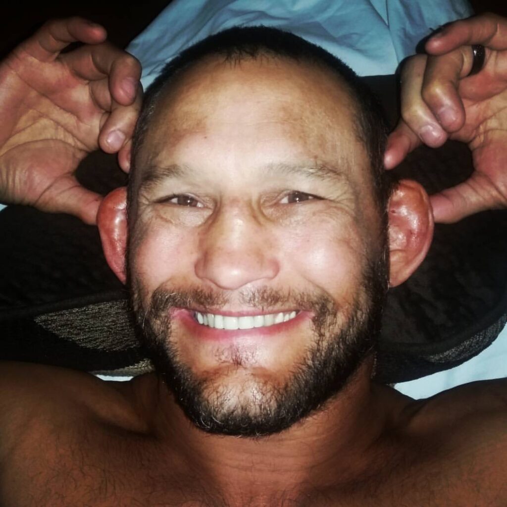 10 worst Cauliflower Ears in MMA/UFC