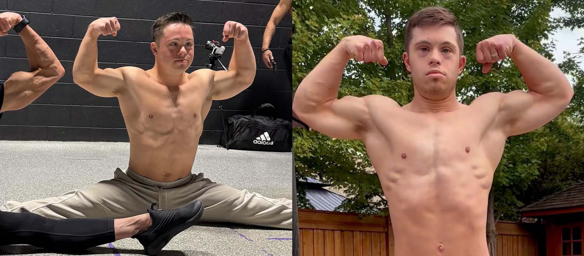 Down syndrome bodybuilder reveals he's on TRT