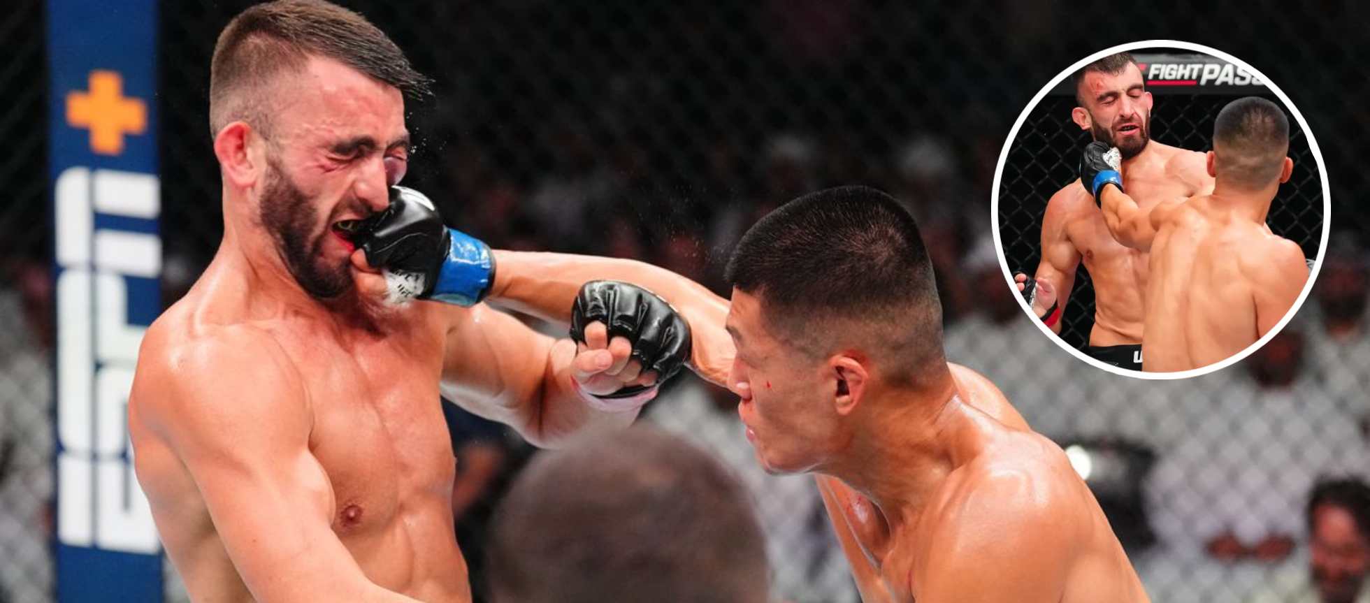UFC star with viral eye injury records no bone breaks after suffering ...
